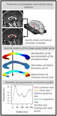 Frontiers | Spectral-based thickness profiling of the corpus callosum enhances anomaly detection ...